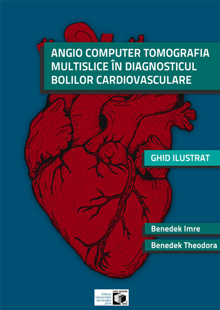 Multislice Angio Computed Tomography in the Diagnosis of Cardiovascular ...
